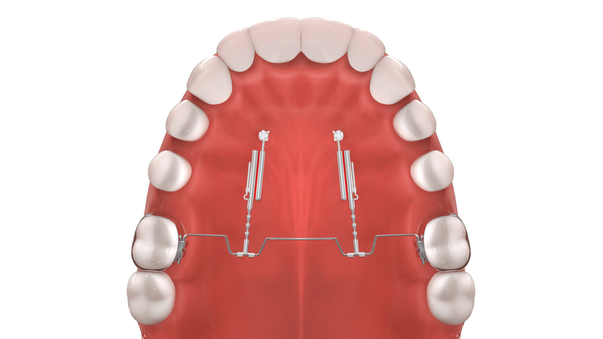 TopJet – TigerDental